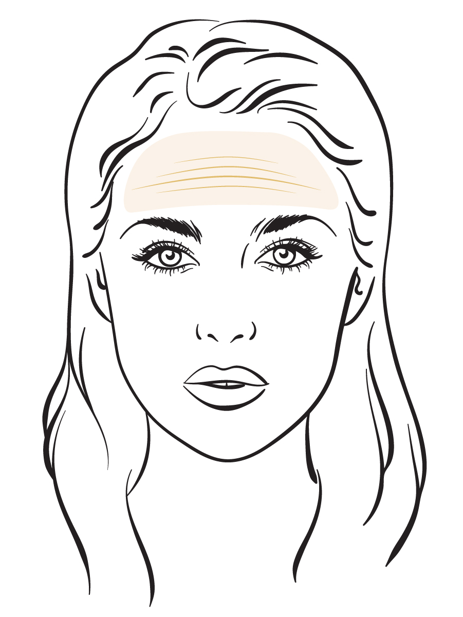 Forehead Lines - Moksha Aesthetics Med Spa